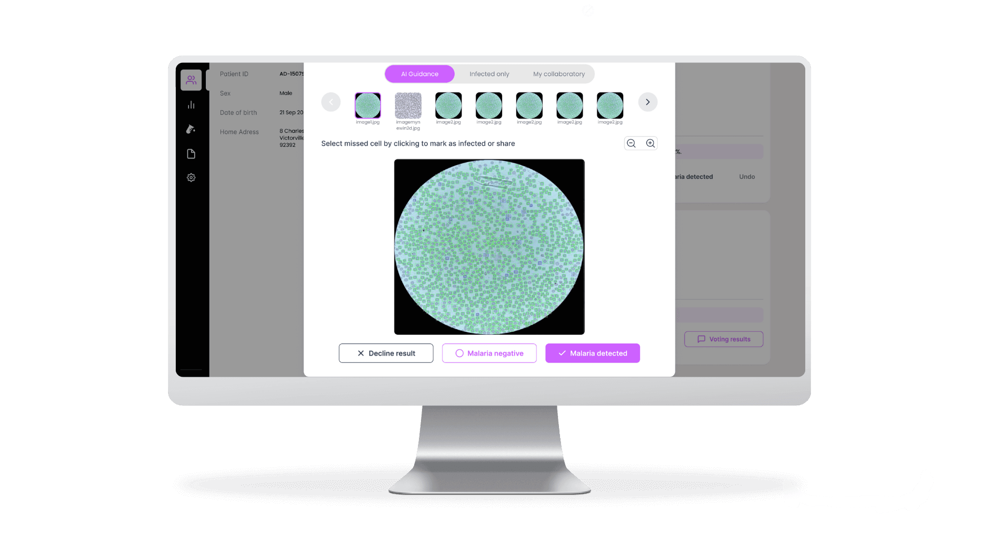 AI Blood Cells Analyzer - Springs Case Study